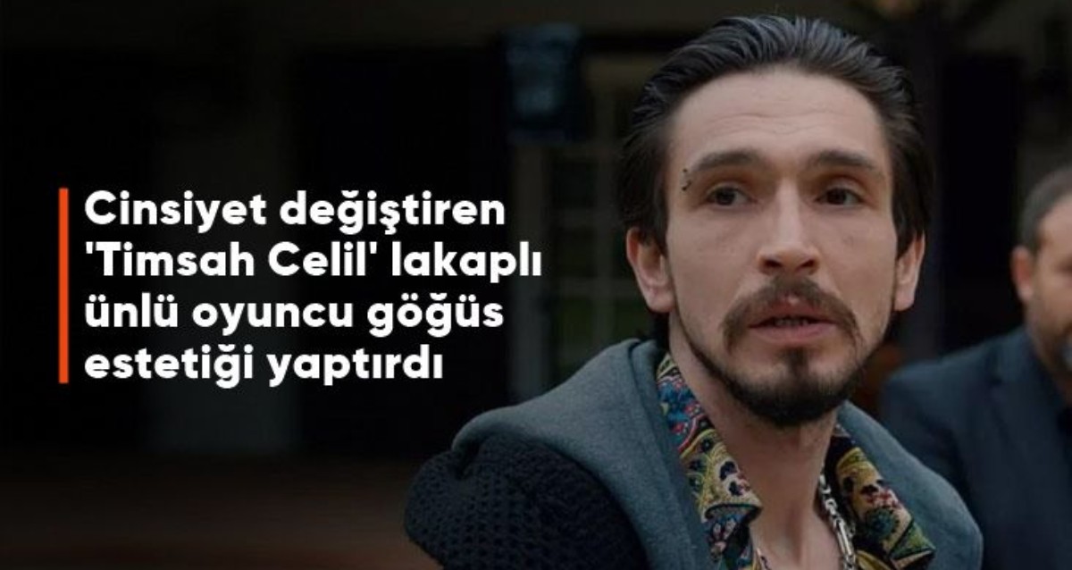 Cinsiyet değiştiren, ve göğüs estetiği olan "Timsah Celil" lakaplı ünlü oyuncu son halini paylaştı.